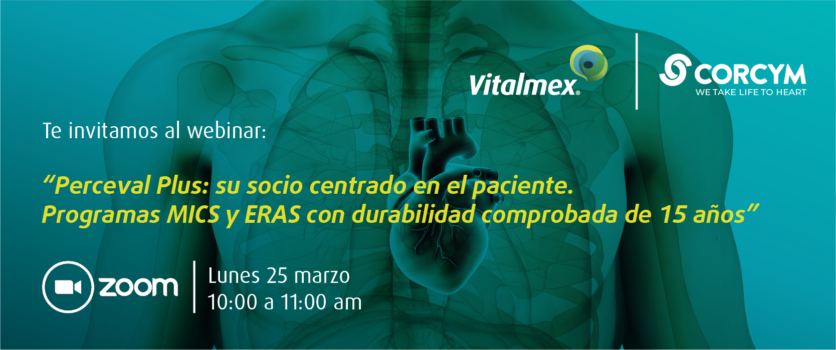 ¿Qué es una válvula sin sutura? Y por qué es una buena opción para mi reemplazo de válvula cardíaca